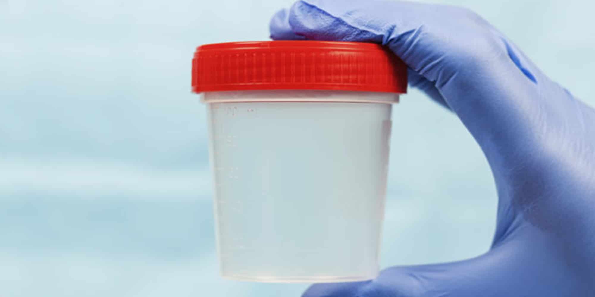 Será que a doação de gameta é para mim? Saiba como funciona - Nilo ...